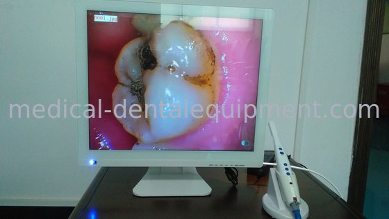 17 Inch LCD Screen Intra Ora Camera Camera Long Life PAL Or NTSC IC-88