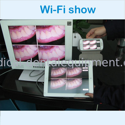 15 Inch LCD WI - FIi Dental Intraoral Camera HAD CCD Support Multi Language