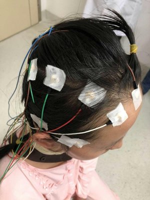 EEG Gold Cup Electrodes