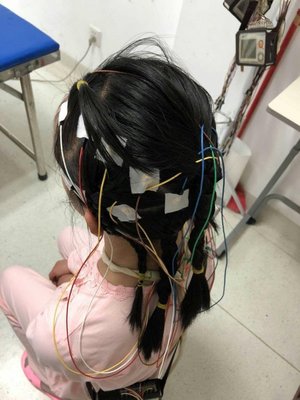 EEG Gold Cup Electrodes