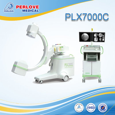 ERCP treatment middle C arm System fluoroscopy PLX7000C