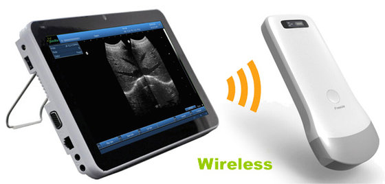 Convex Array wireless scanner wireless ultrasound machine system