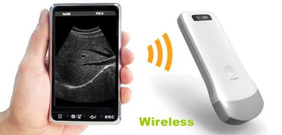 Convex Array wireless scanner wireless ultrasound machine system