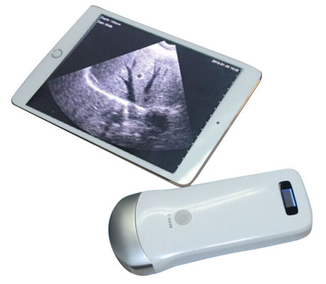 Convex Array wireless scanner wireless ultrasound machine system