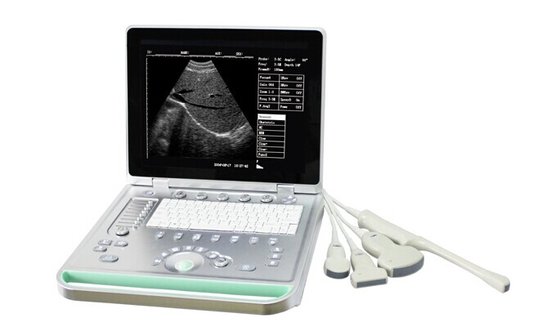 Laptop Ultrasound scanner black and white Laptop ultrasound machine system