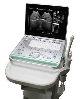 Laptop Ultrasound scanner black and white Laptop ultrasound machine system