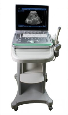 4D Laptop ultrasound scanner ultrasound system machine 4D image