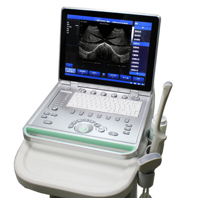 ARM based Laptop ultrasound scanner machine system