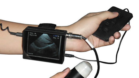 Wrist Veterinary ultrasound scanner wrist veterinary ultrasound machine