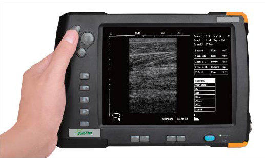 Palm ultrasound scanner Handheld ultrasound scanner machine black and white