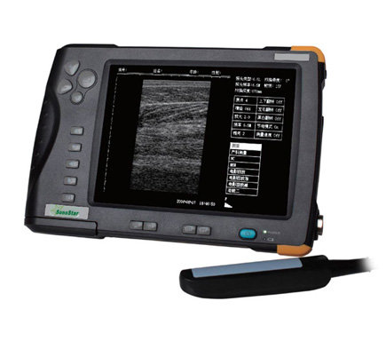 Palm ultrasound scanner Handheld ultrasound scanner machine black and white