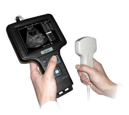 Handheld ultrasound scanner Handheld ultrasound machine system
