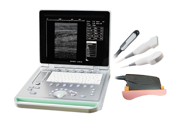 Laptop Ultrasound scanner black and white Laptop ultrasound machine system