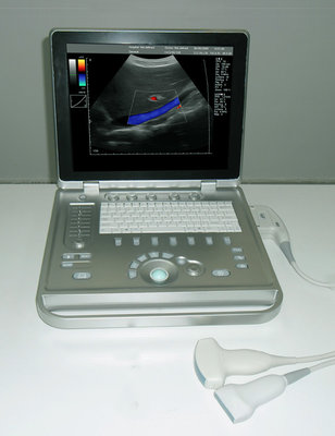 Laptop Color Doppler ultrasound system Laptop color doppler ultrasound machine