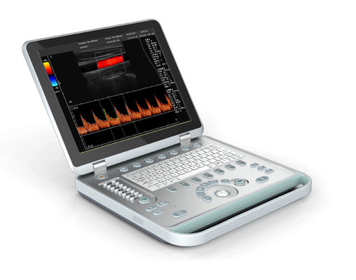 Laptop Color Doppler ultrasound system Laptop color doppler ultrasound machine
