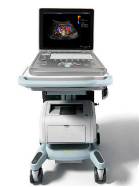 Laptop Color Doppler ultrasound system Laptop color doppler ultrasound machine