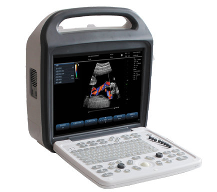 3D/4D color doppler ultrasound system ultrasonic color doppler scanner 3D/4D
