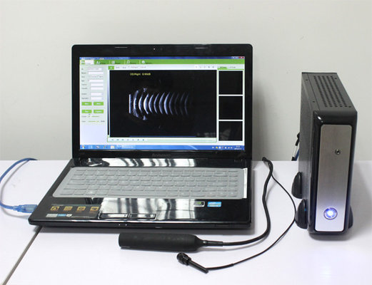 Ophthalmic A/B scanner Ophthalmic ultrasound scanner