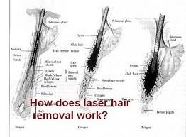 Pain free 808nm Diode Laser Hair Removal Machine (paypal accept)