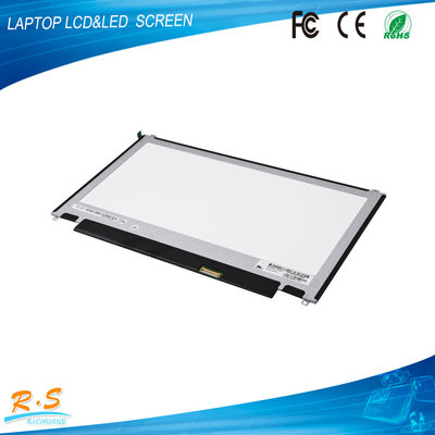 15,6 bewegen Sie dünnes Laptop-Anzeigefeld FHD Wxga 1920X1080 B156HNA03.0 Schritt für Schritt fort