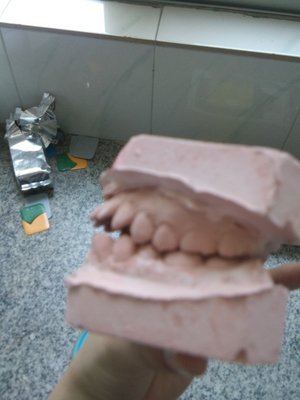 dental plaster - China HS code & import tariff for dental plaster