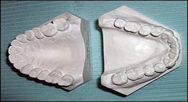 dental plaster spatula - China HS code & import tariff for dental plaster