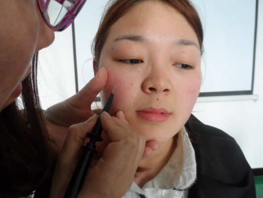 RF Spider Vascular Portable Machine/Painfree Facial Veins Removal machine