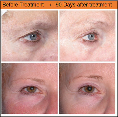 Hifu Face lifting Beauty mahcine/ HIFU Body and Face/ HIFU Face Lifting/ HIFU Body Slimmin