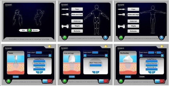 Sanhe HIFU-2V hifu shape high intensity focused ultrasound hifu