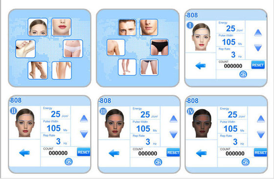 Sanhe 2016 New arrival Most advanced 808nm diode laser hair removal machine with CE