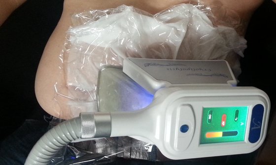 SHC-2 Slimming Machine antifreezeThereapy Lipo Cryo With cryo antifreeze membrane