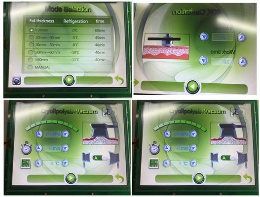 SHC-2 cryo slimming device rf/ cryo device/ cryo slimming/ with CE approval