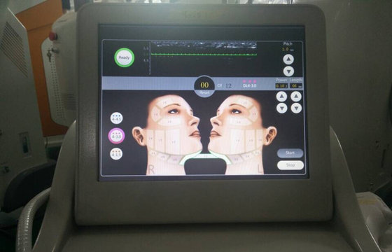 Non-invasive High Intensity Focused Ultrasound HIFU Machine For Wrinkle Removal , Facial Lift supplier
