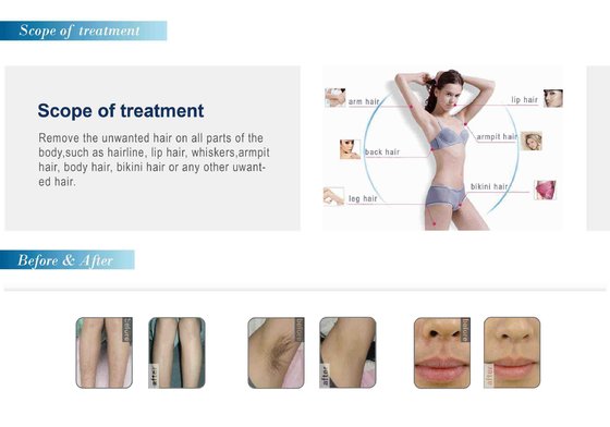 Professional laser hair removal Alexandrite laser 755nm hair removal equipment