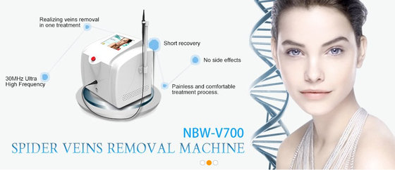 Best treatment for varicose and spider veins spider veins vascular removal equipment