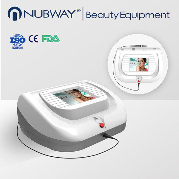Laser treatment for broken capillaries Best treatment for varicose and spider veins