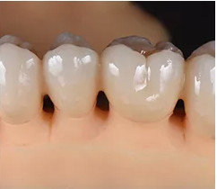 Dental ZrO2 Zirconium Oxide  Powder  3y 4y 5y Used For Dental Block
