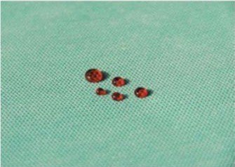SMS non woven fabric for disposable hospital gowns