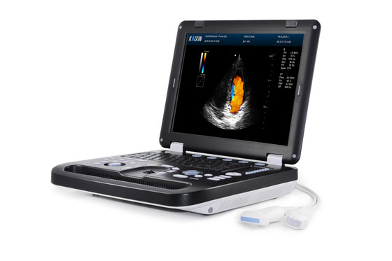 Cheap Laptop 3D/4D Color Doppler Ultrasound, CW Cardiac Ultrasound, OB Ultrasound, GYN Ultrasound, Abdomen Imaging, OBG