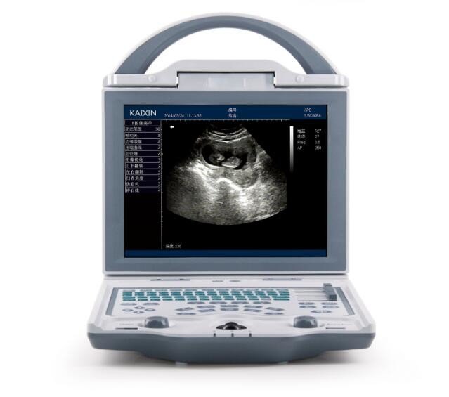 Portable Veterinary Ultrasound KX5600V Herd Health Pet Bovine Swine Ovine Equine Dog Cat Ultrasound Sonar