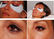 Orange RF Eye Treatment Machine For Skin Tightening / Wrinkle Removal