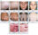 1000W Portable Ipl Permanent Hair Removal Machine 650 - 950nm For HR