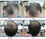 LLLT Low Level Laser Multifunction Beauty Machine Anti - Hair Loss