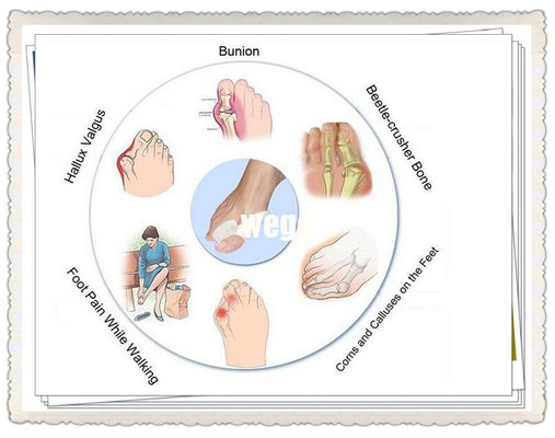 Valgus pro gel bunion separator