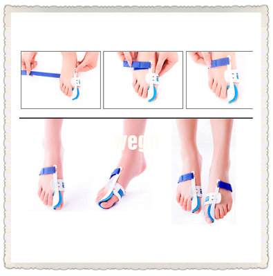 Beetle Crusher Bone Ectropion Toe Separator Outer Orthotics Appliance