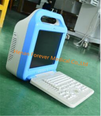 Yj-Ua100 High Speed Automatic Urine Analyzer for Hospitals