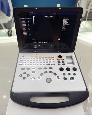 One Key Regulation Portable Ultrasound Scanner with wholesale price