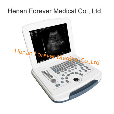 Hot Selling Full-Digital B/W Laptop Ultrasound Scanner (YJ-U580)