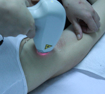 Adjustable 808nm Diode Laser Hair Removal System , Professional Laser Hair Removal Equipment